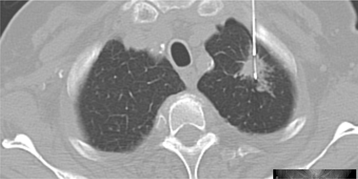 Multi Slice Ct Scan Capital Diagnostic Centre