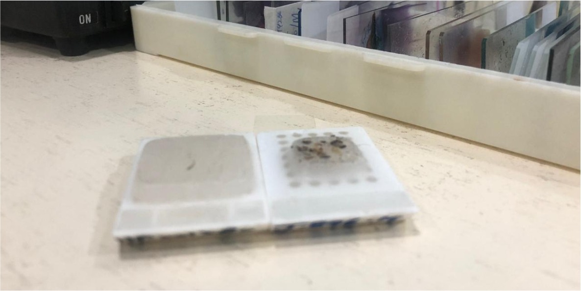 Special Pathology - Capital Diagnostic Centre