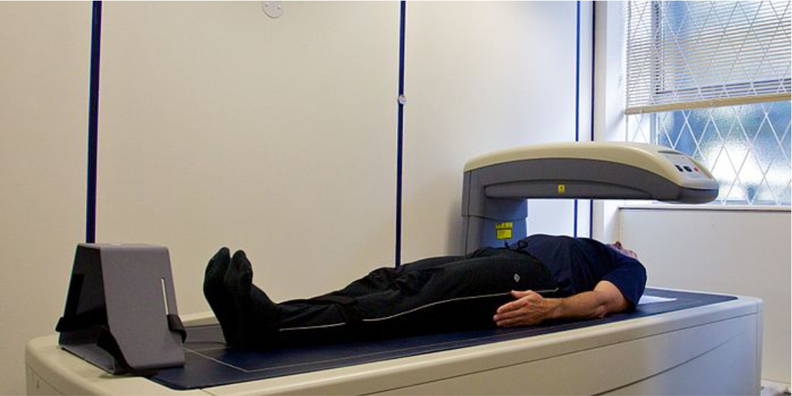 Dexa Scan - Capital Diagnostic Centre